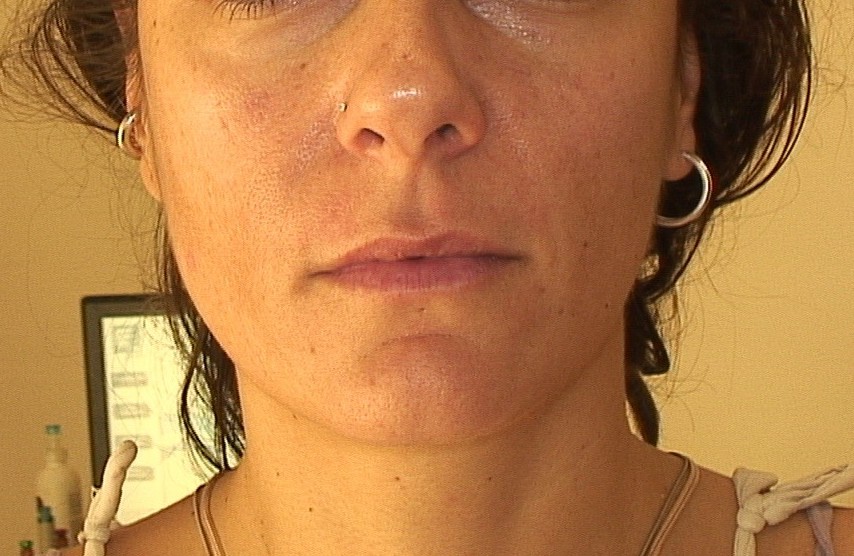 ΜΕΣΟΘΕΡΑΠΕΙΑ – Secret of Skin Δερματολόγος Ευγενία Σταυροπούλου